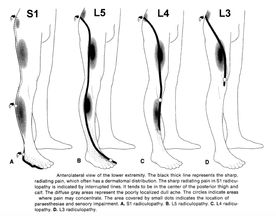 Spine – bonesbonesbones