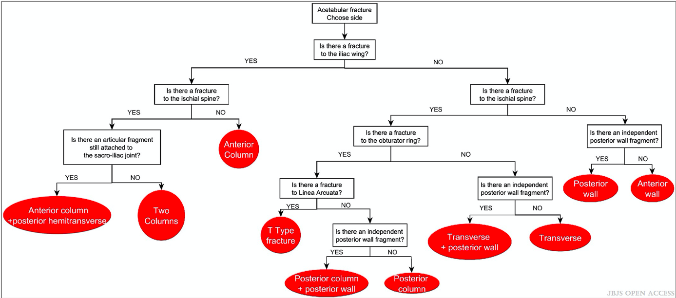 Letournel Classification of Acetabular Fractures – bonesbonesbones